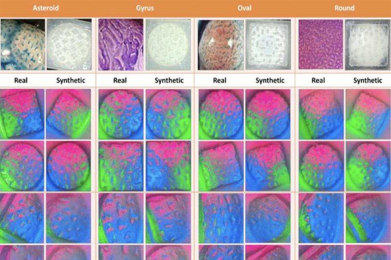 AI in the GI | Texas ECE - Electrical & Computer Engineering at UT Austin